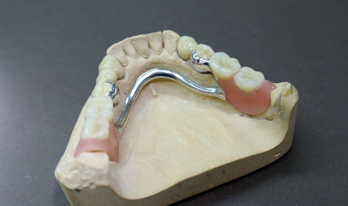 Zahnersatz – Zahnarztpraxis