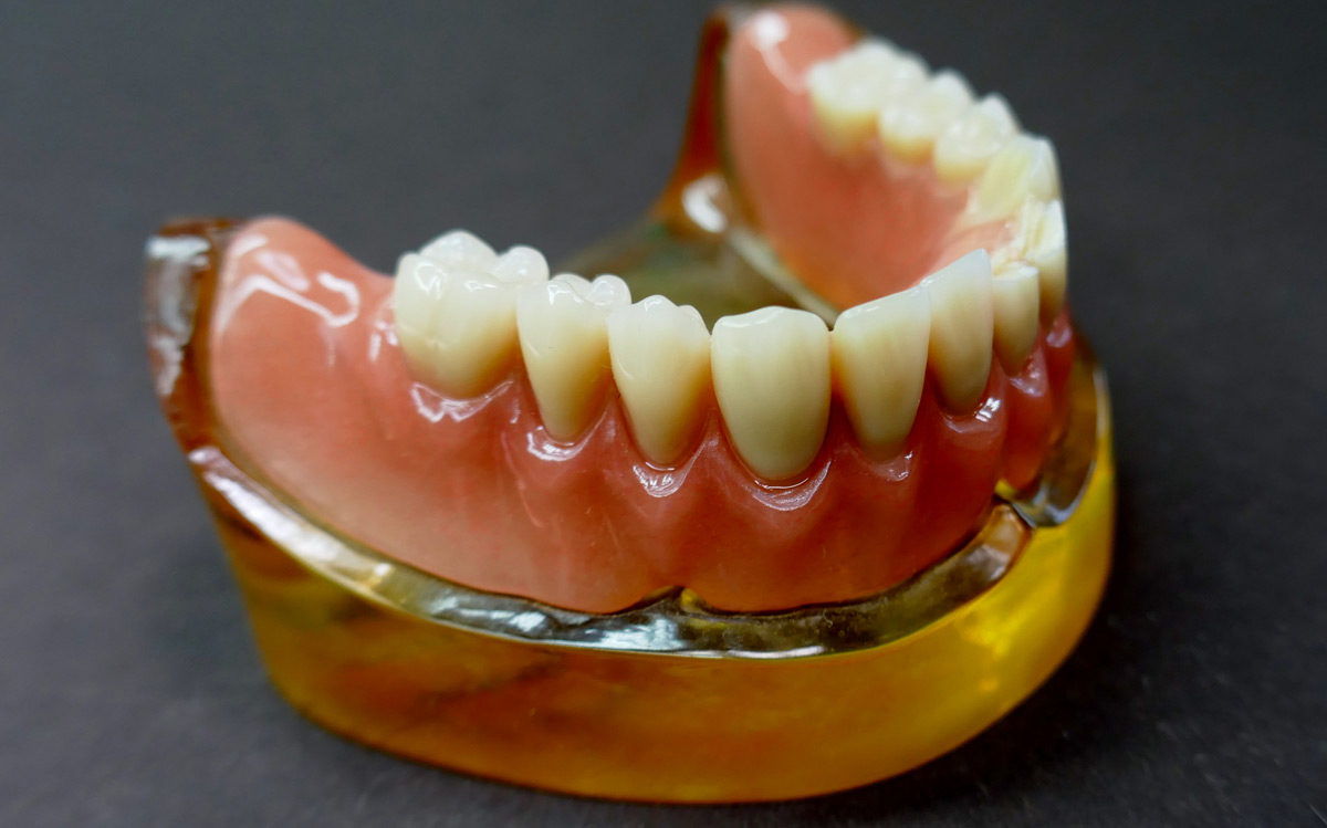 Zahnersatz – Zahnarztpraxis